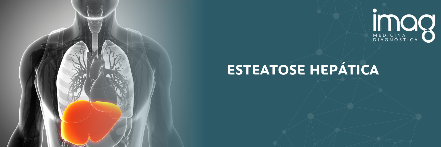Esteatose Hepática: Você Sabe O Que É? – SJSF